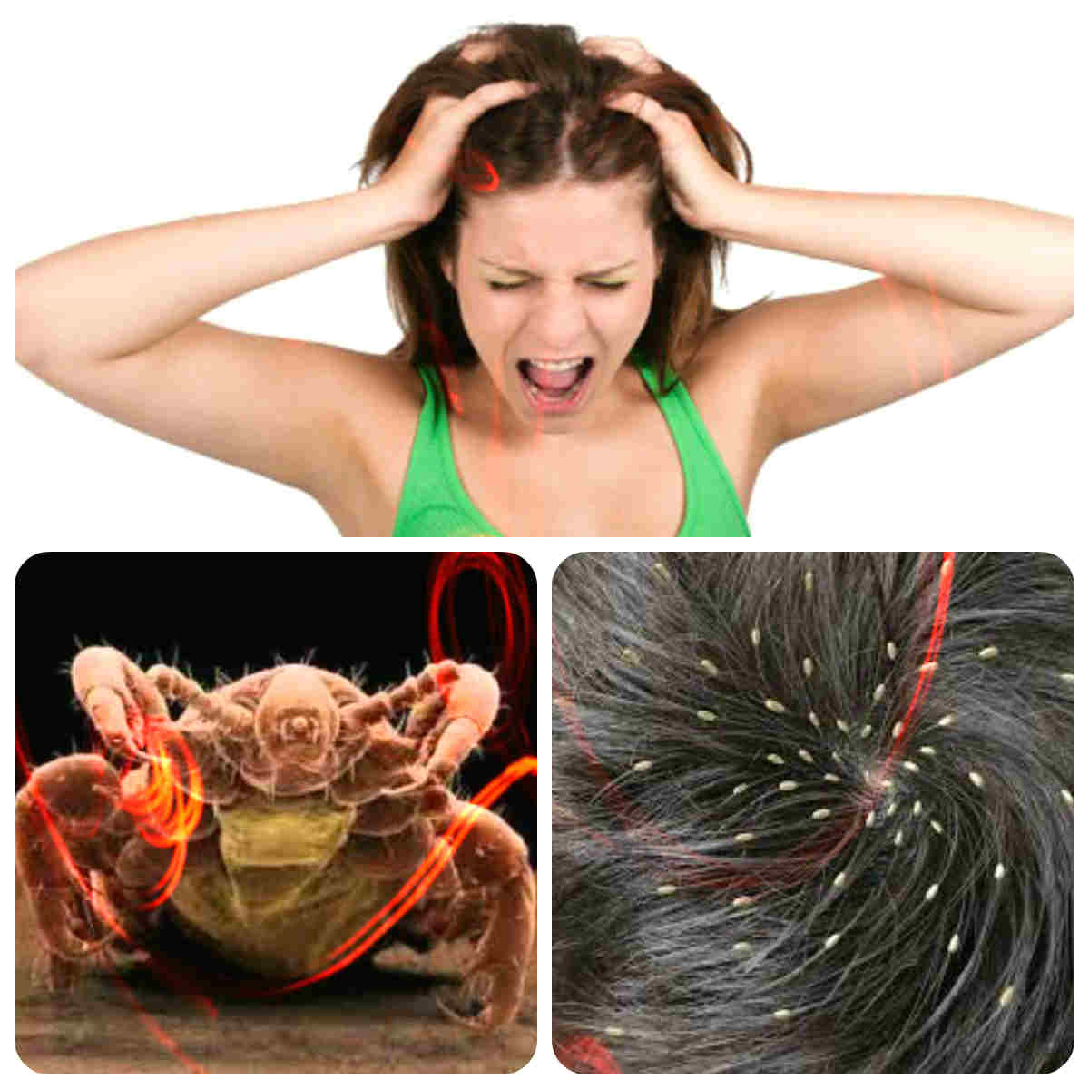 Soñar con piojos ¿Que Significa? Explicación 100% Real!